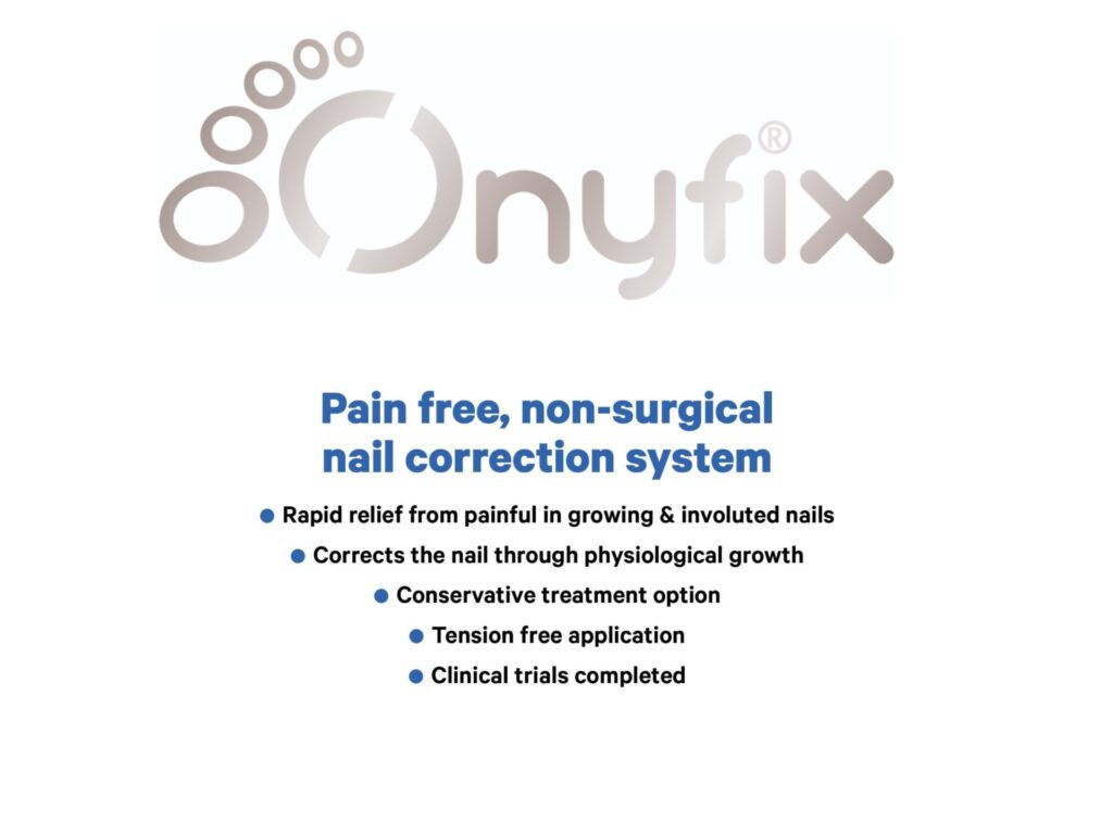 Onyfix - Waterford Foot Clinic